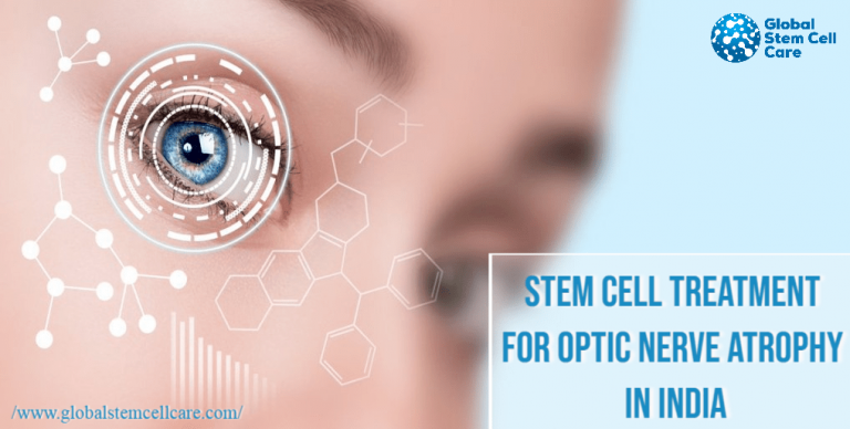 How can stem cells help to treat optic nerve issues? - Global Stem Cell ...